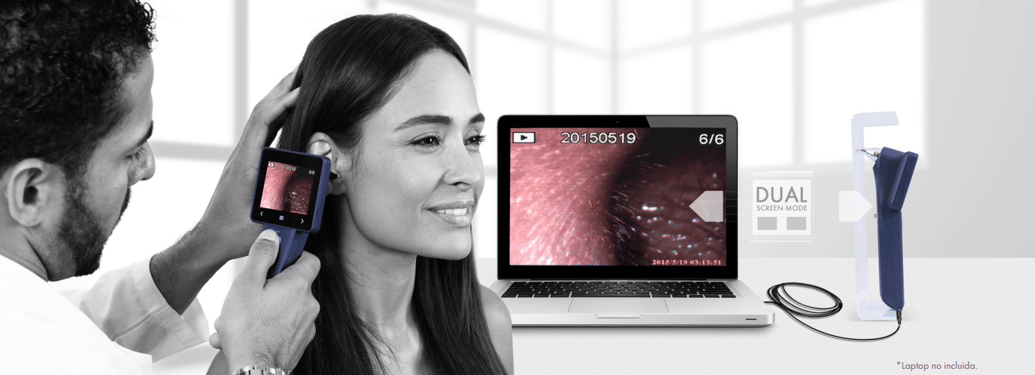 Otoscopio digital con cámara - Audiomax